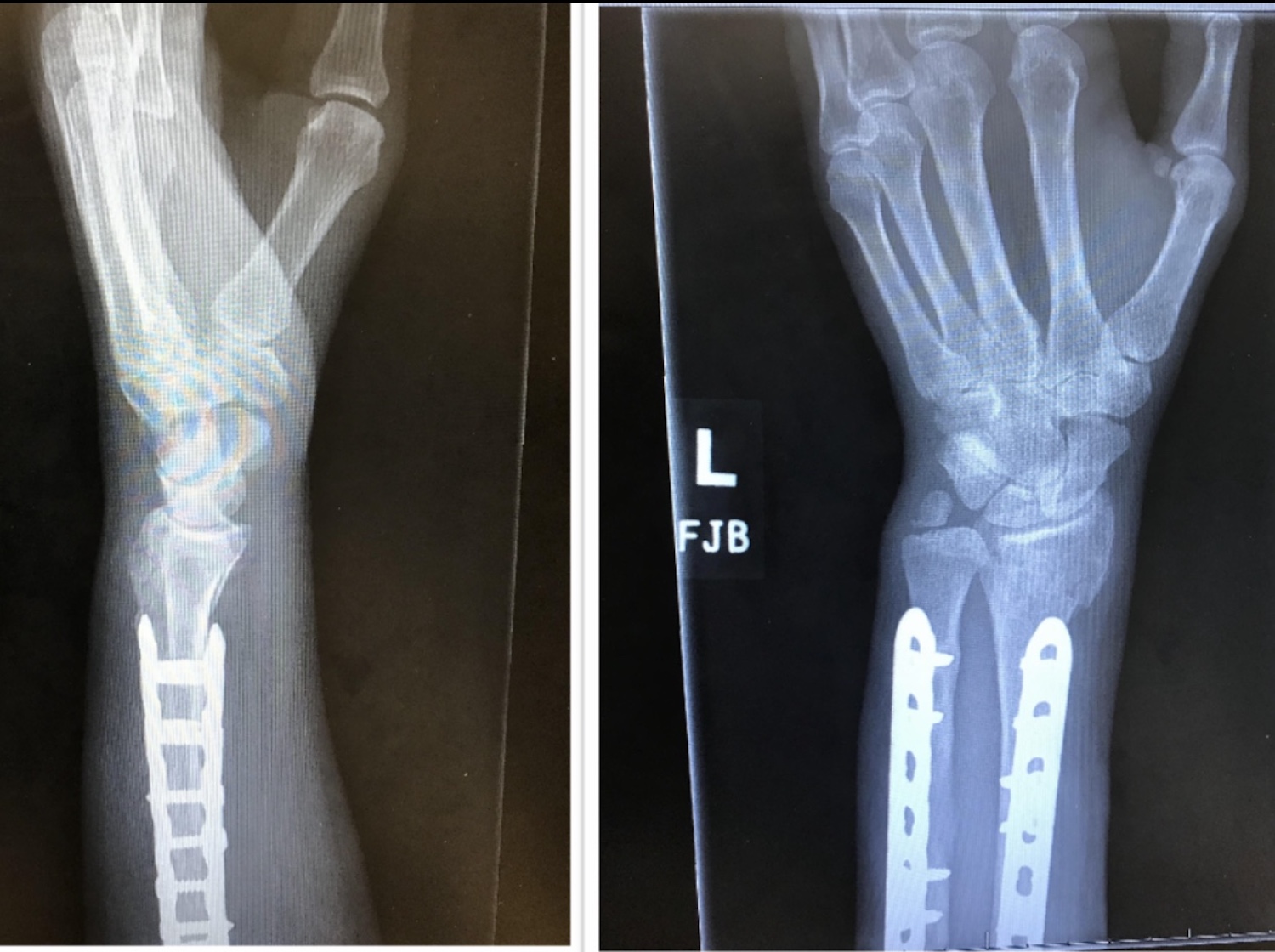 Going Out With a Bang | KONA COG